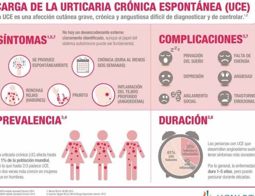 Síntomas y tratamiento de la urticaria en la infancia